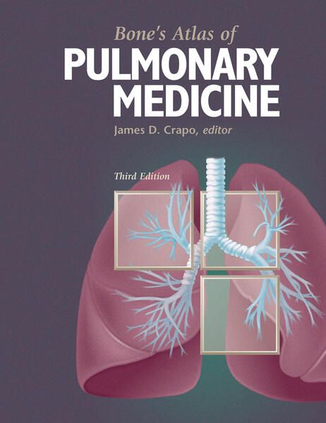 Bone's Atlas of Pulmonary Medicine - Medizin Software | Thalia