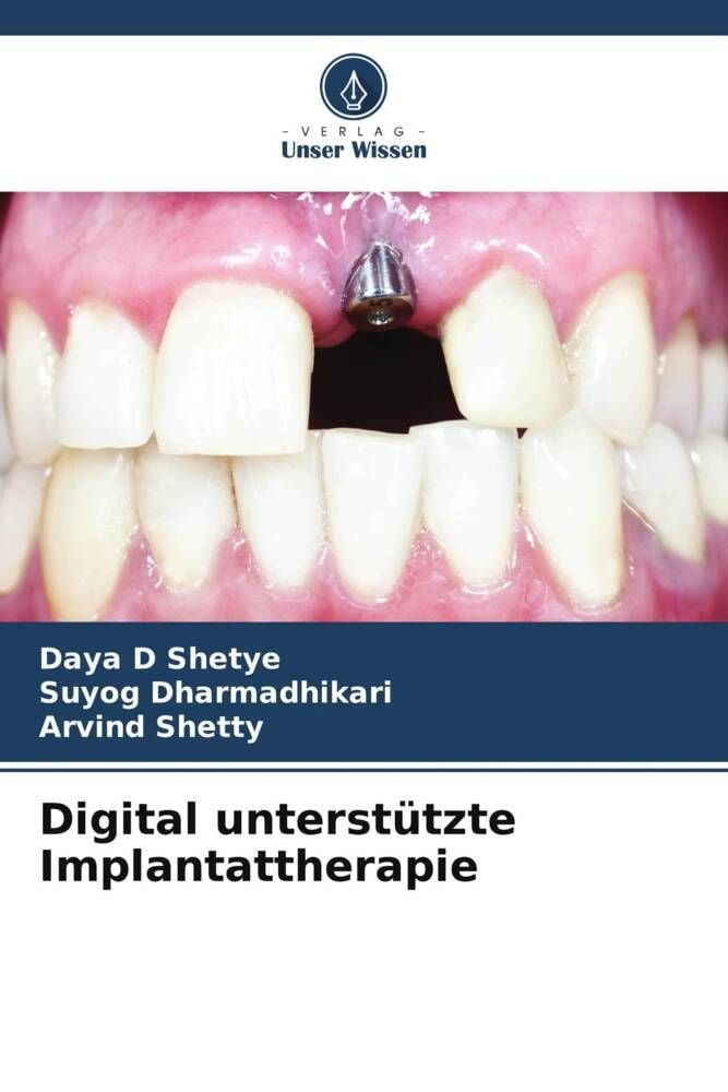'Digital unterstützte Implantattherapie' von 'Daya D. Shetye' - Buch ...