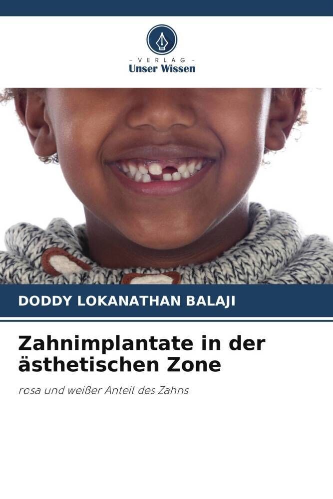 'Zahnimplantate in der ästhetischen Zone' von 'Doddy Lokanathan Balaji ...