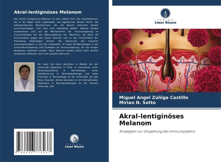 "Zúñiga Castillo, M: Akral-lentiginöses Melanom" online kaufen