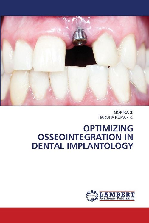 "Optimizing Osseointegration in Dental Implantology" auf Englisch kaufen