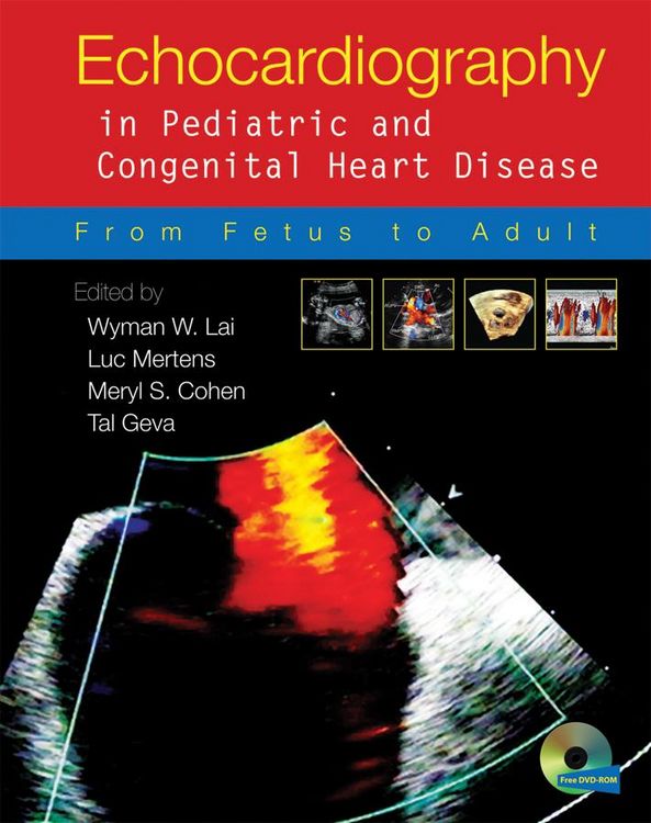 "Echocardiography in Pediatric and Congenital Heart Disease" als eBook ...
