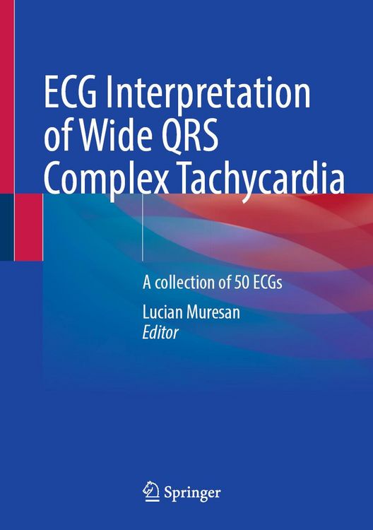 "ECG Interpretation of Wide QRS Complex Tachycardia" als eBook kaufen