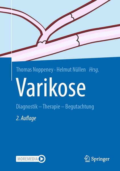 "Varikose" bei bücher.de bestellen