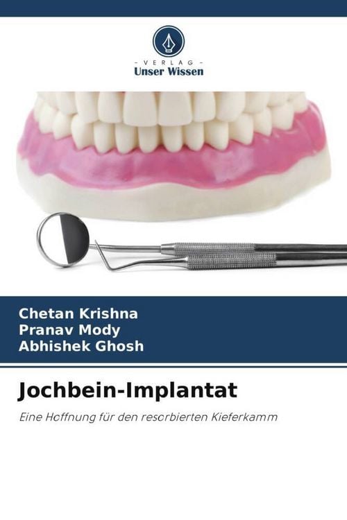 "Jochbein-Implantat" online kaufen