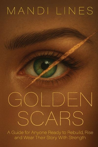 "Golden Scars" auf Englisch kaufen