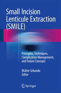 "Small Incision Lenticule Extraction (SMILE)" auf Englisch kaufen