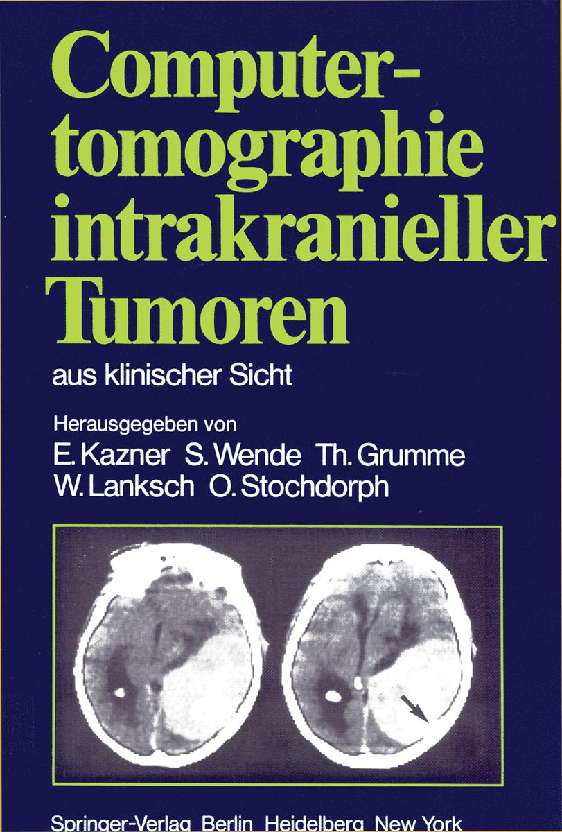 "Computertomographie intrakranieller Tumoren aus klinischer Sicht ...