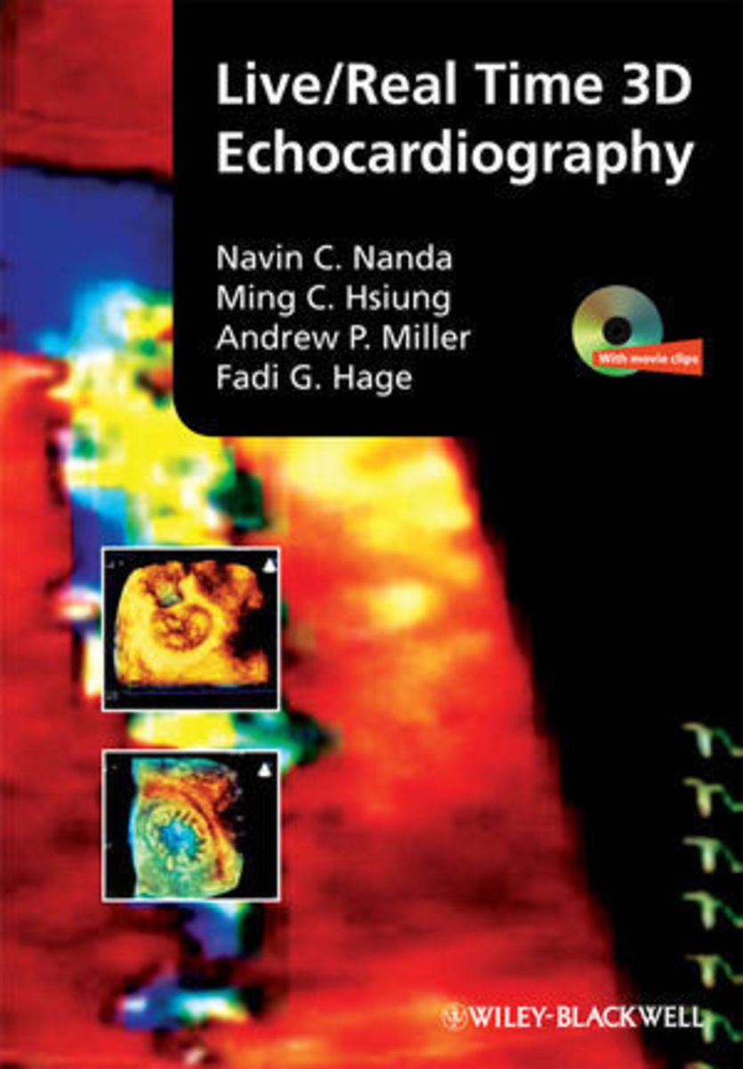 'Live/Real Time 3D Echocardiography' von 'Navin Nanda' - 'Gebundene ...