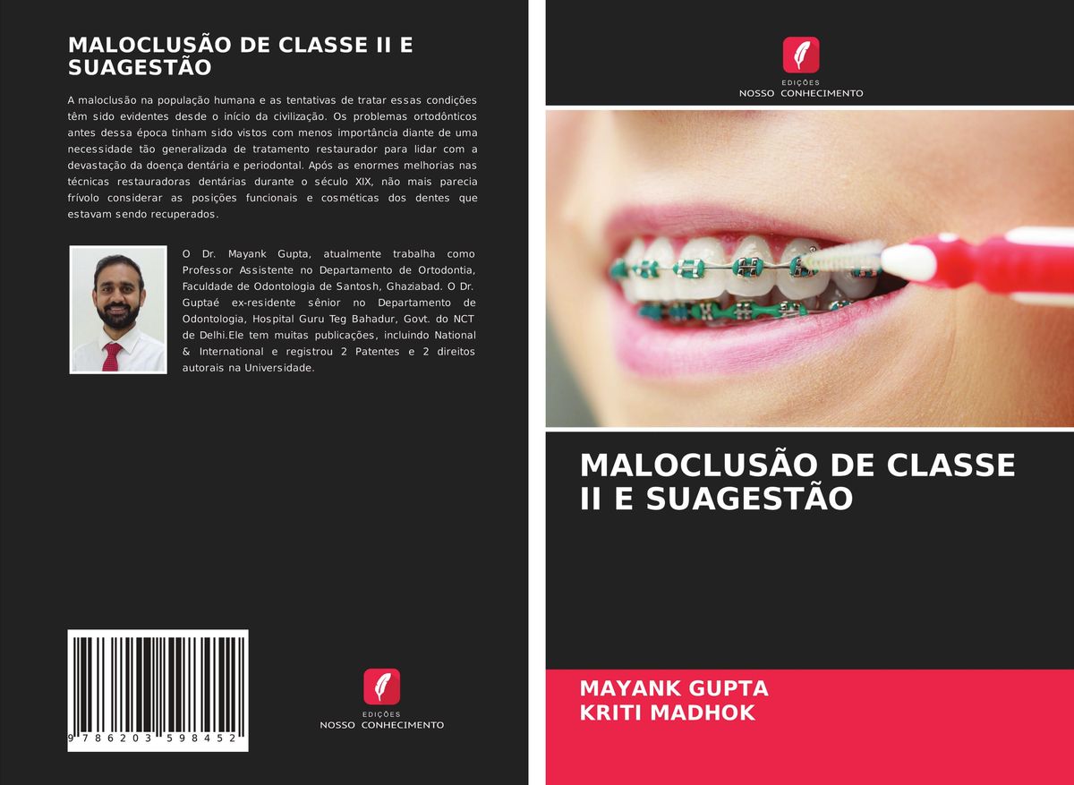 'Maloclusão De Classe Ii E Suagestão' von 'Mayank Gupta' - 'Taschenbuch' - '978-620-3-59845-2'