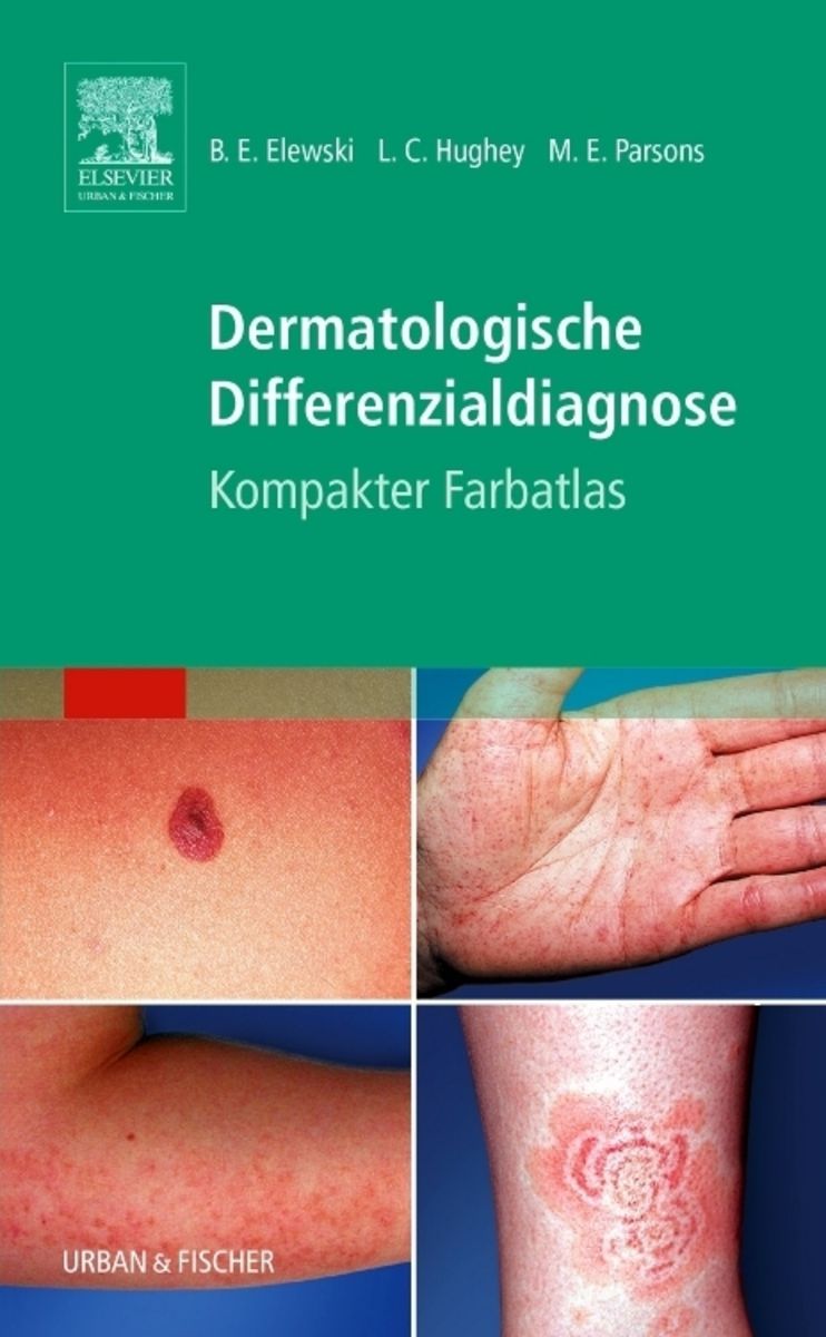 'Dermatologische Differenzialdiagnose' von 'Boni E. Elewski' - Buch ...